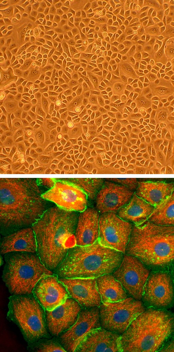 HCEpC | Human Corneal Epithelial Cells | Life Technologies (India) Pvt ...