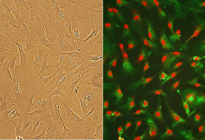 Organoids - DECODING DISEASE, ONE MINI-ORGAN AT A TIME| Life ...